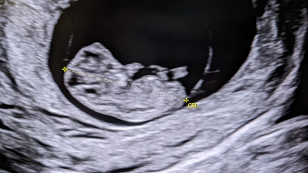 Prenato – Ma clinique d’accompagnement prénatal